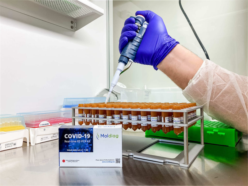 Morocco’s MAScIR Develops a Diagnostic Kit for COVID-19