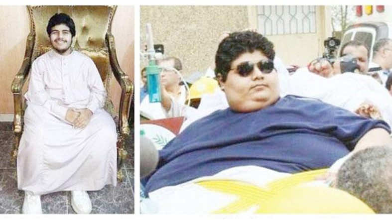 World's Heaviest Man Loses More Than 500 Kg in Four Years